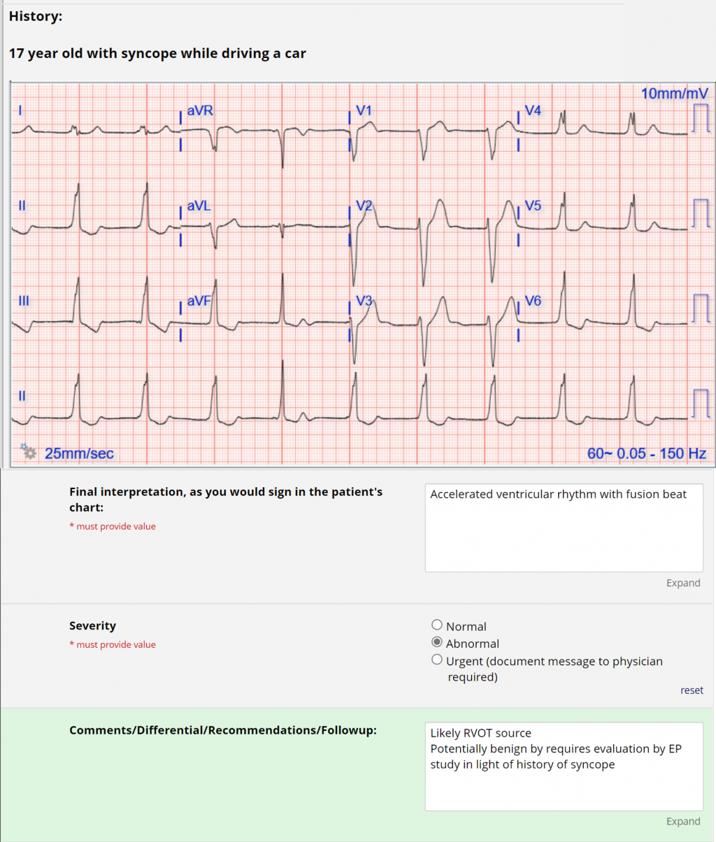 Example: Weekly ECG – Pediatric ECG Review